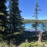 Lake Annette Loop [CLOSED], Alberta, Canada - 911 Reviews, Map | AllTrails